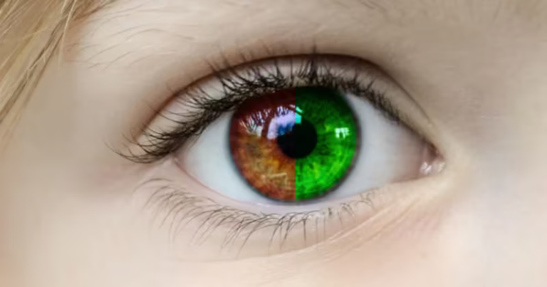 Exploring Different Shades of Green Eyes and Reason Behind