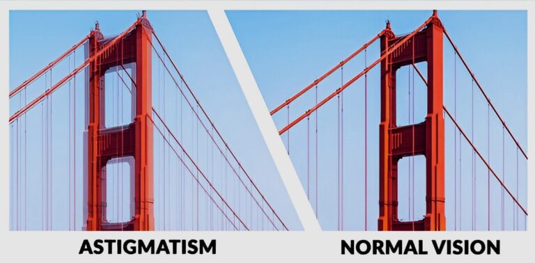 Astigmatism vs Normal Vision: How It Affects Your Sight
