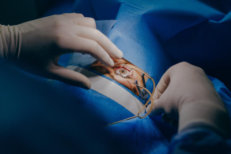 How Long Does LASIK Last? A Comprehensive Guide to LASIK